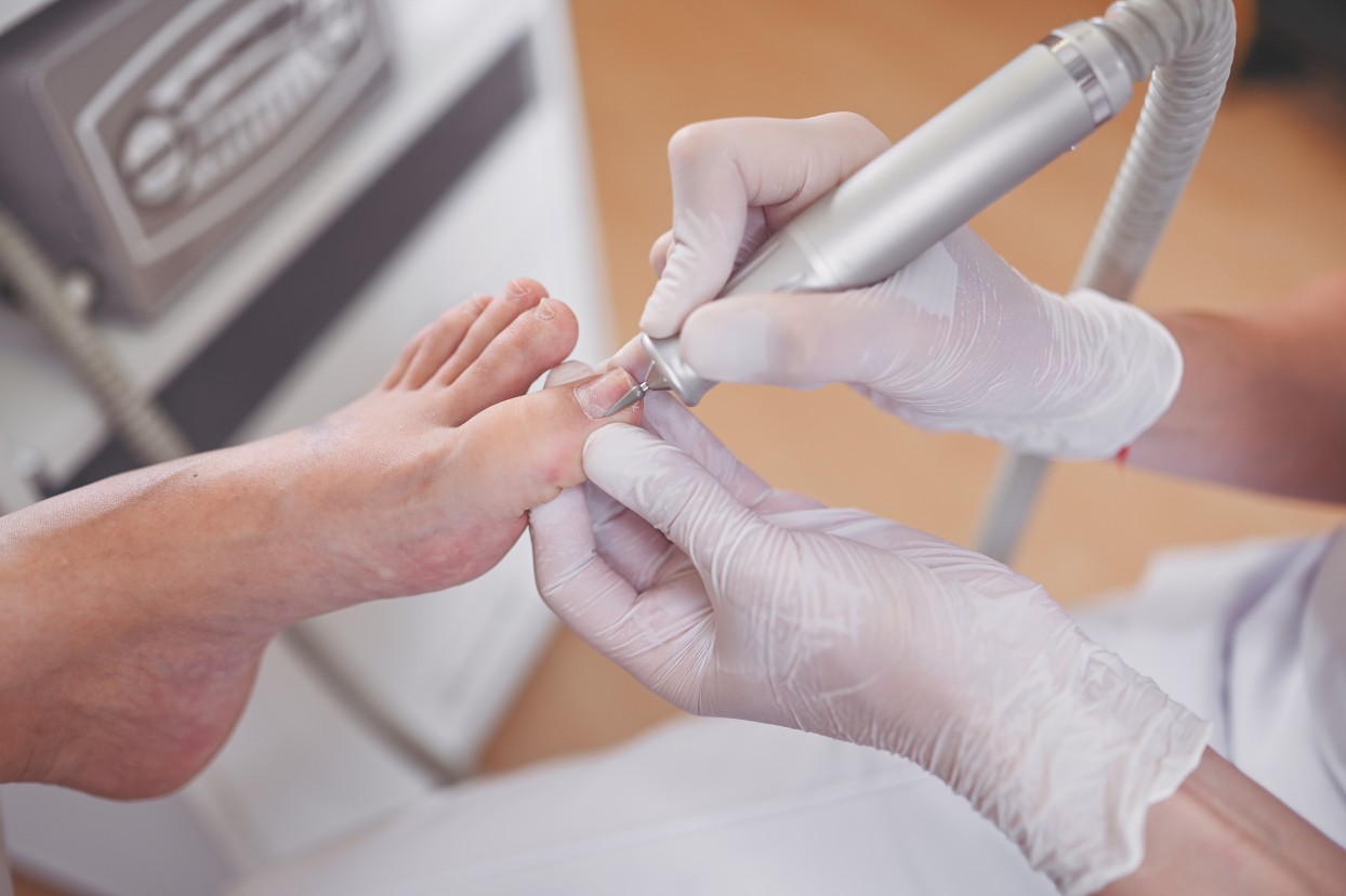 Advanced Treatment Technology – Perform Podiatry