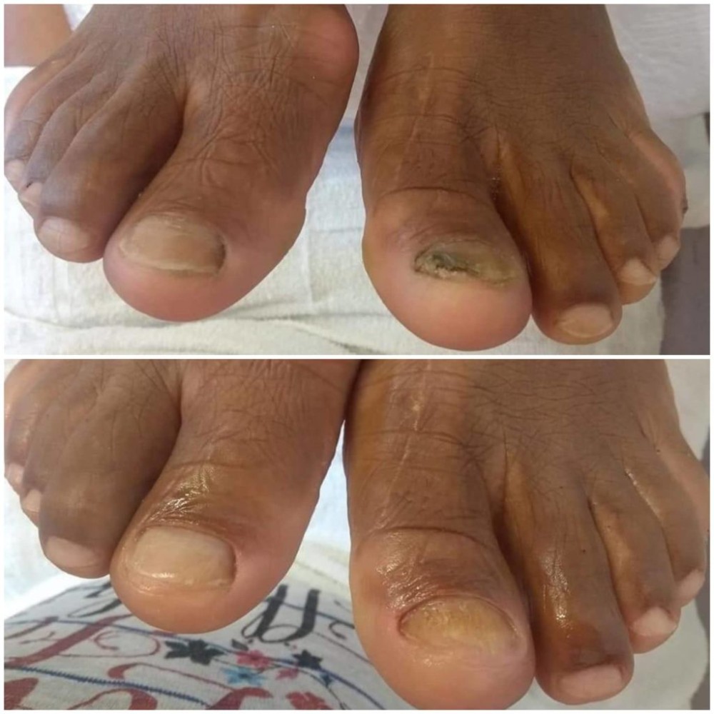 Perform Podiatry - Skin & Nail Problems